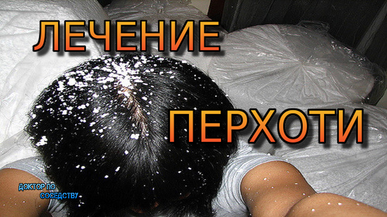 Как избавиться от перхоти? Доктор по соседству.