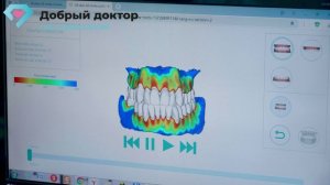 Элайнеры - исправление прикуса .