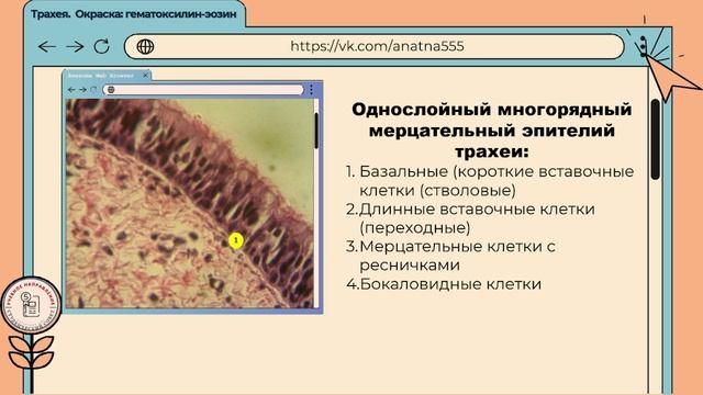 трахея
