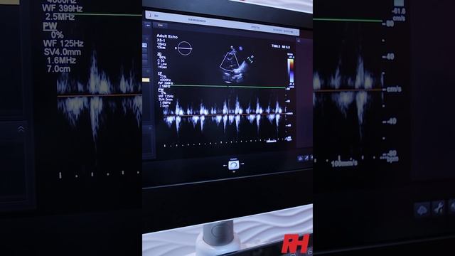 Philips CVX