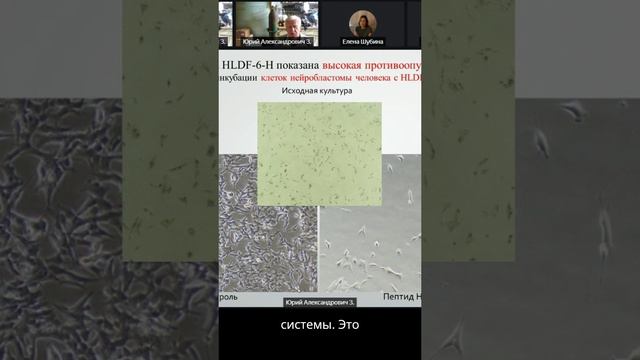 Нейробластома VS Пептид HLDF-6-H 
Профессор о результате 20-летнего научного труда