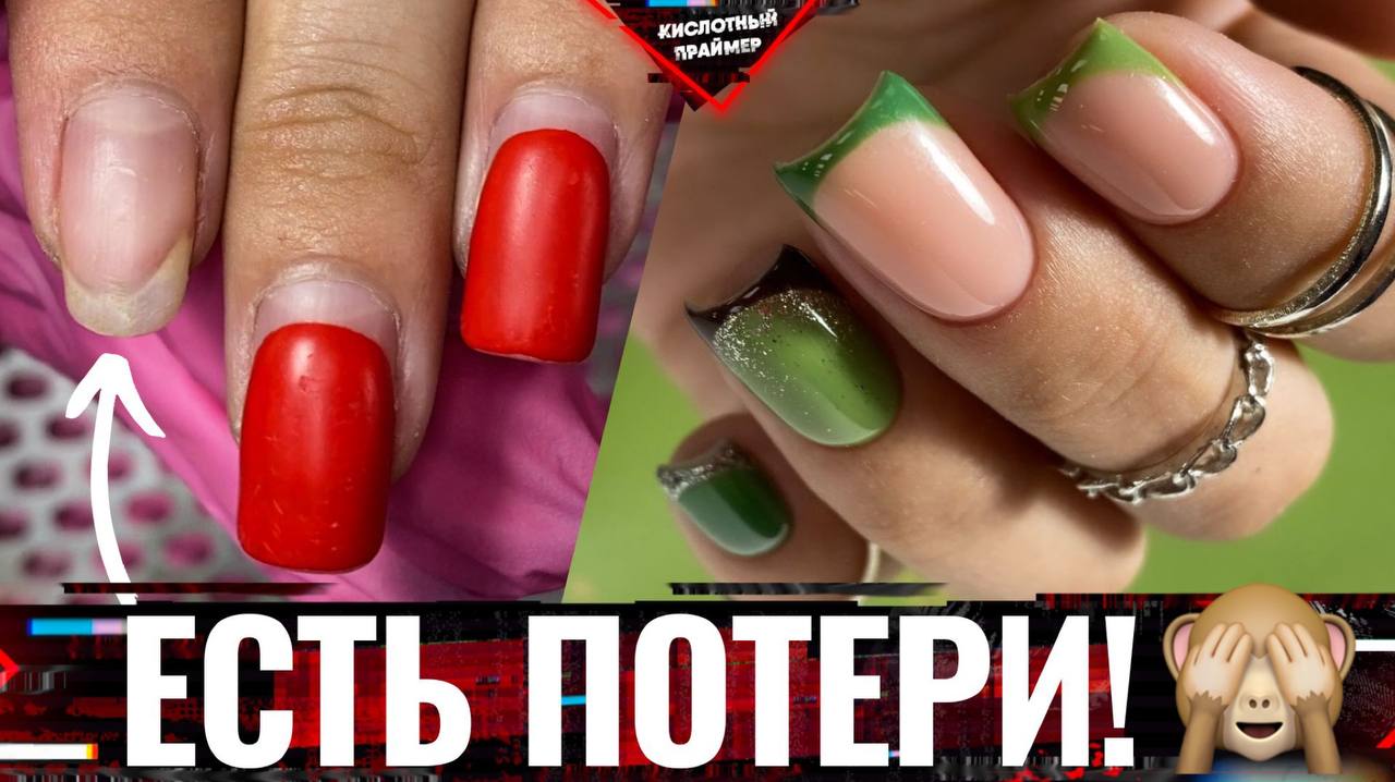 😍1,5 МЕСЯЦА и ОТСЛОЙКИ на ВСЕХ НОГТЯХ! | ОСЕННИЙ ЗЕЛЕНЫЙ ФРЕНЧ с БЛЕСТКАМИ!🔥 Зеленый маникюр