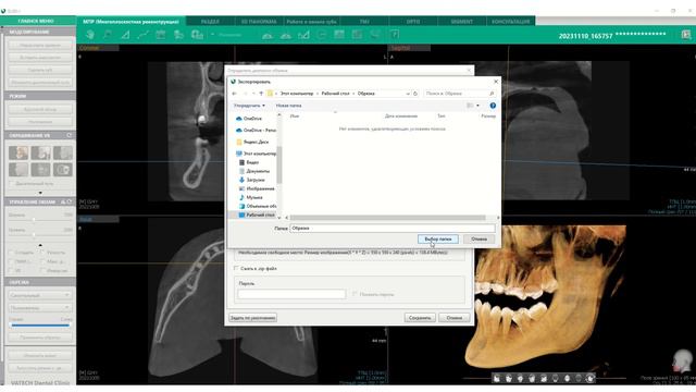 Обрезка объема из КТ