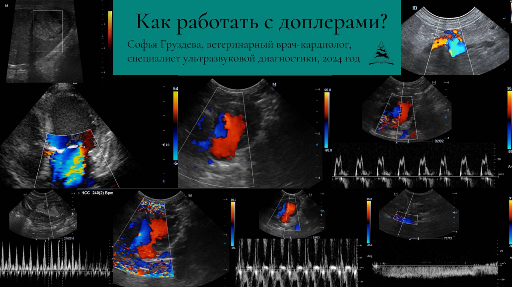 Как работать с доплерами? Цветной, энергетический, импульсно-волновой, постоянно-волновой, тканевой