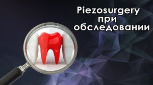Использование пьезоинструментов во время обследования