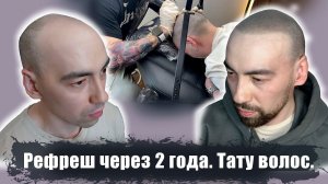 Обновление цвета через время! Трихопигментации лучше чем пересадка волос Scalp Micropigmentation SMP