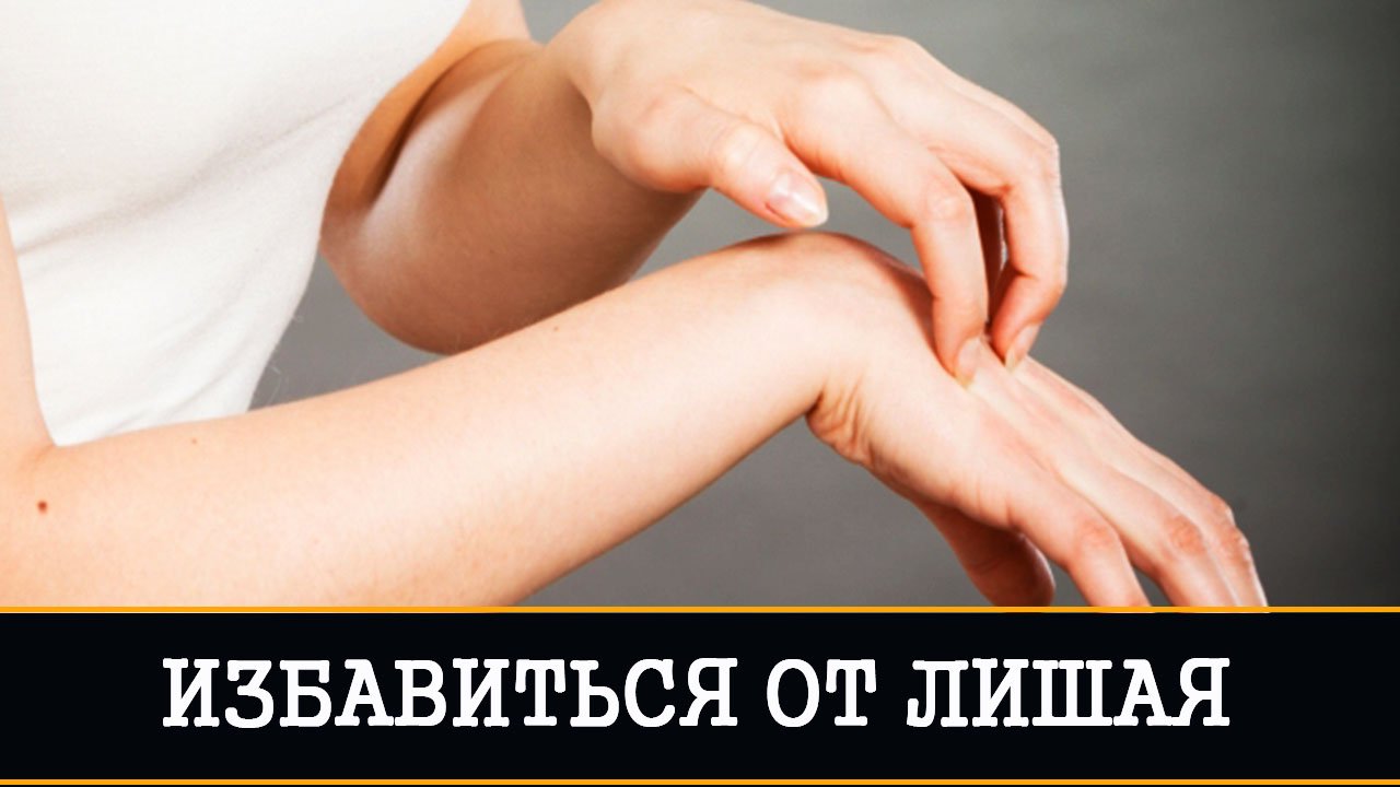 ОТ ЛИШАЯ | ОЧЕНЬ СИЛЬНЫЙ ЗАГОВОР | ИНГА ХОСРОЕВА | ВЕДЬМИНА ИЗБА