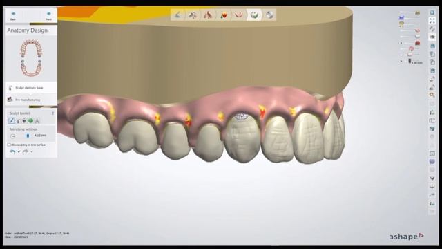 Зубы AcrySmart в 3Shape Italy