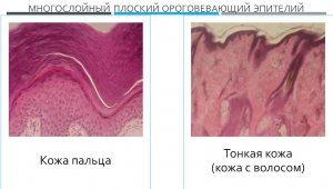 2. Многослойный ороговевающий эпителий