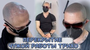 Перекрытие чужой работы трихопигментации после мастера татуажа Scalp Micropigmentation SMP