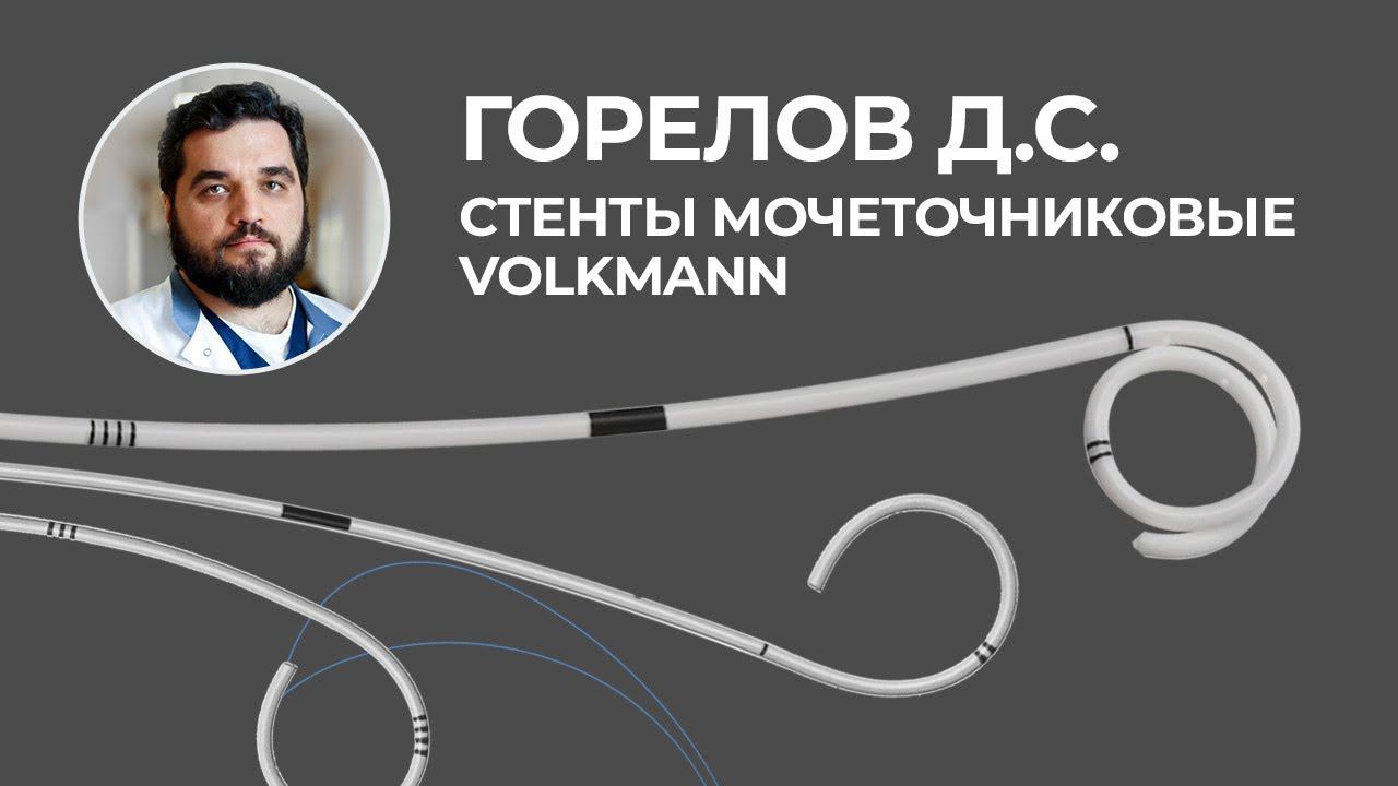 Отзыв о мочеточниковых стентах Volkmann. Дмитрий Сергеевич Горелов.