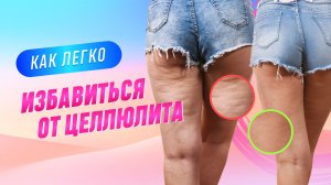 Как легко избавиться от целлюлита | Яна Логвина