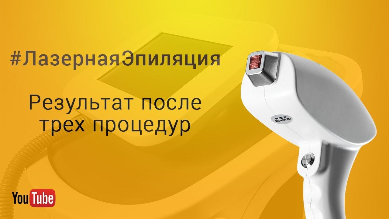 ЛАЗЕРНАЯ ЭПИЛЯЦИЯ | СЕРИЯ 4 | СОВМЕСТНЫЙ ПРОЕКТ С КЛИНИКАМИ | ОТЗЫВЫ РЕАЛЬНЫХ ДЕВУШЕК