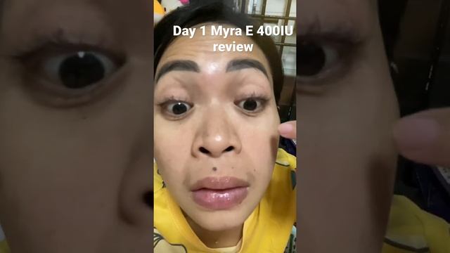 Day 1 for Myra E 400IU review