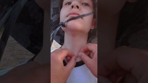 Как вытащить клеща ниткой. сын поймал клеща