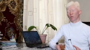 "Мне больно когда на меня смотрят" Казахстанец с добрым сердцем но .........  До слёз История