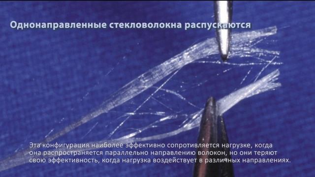 Сравнение волокон Ribbond с другими материалами для шинирования
