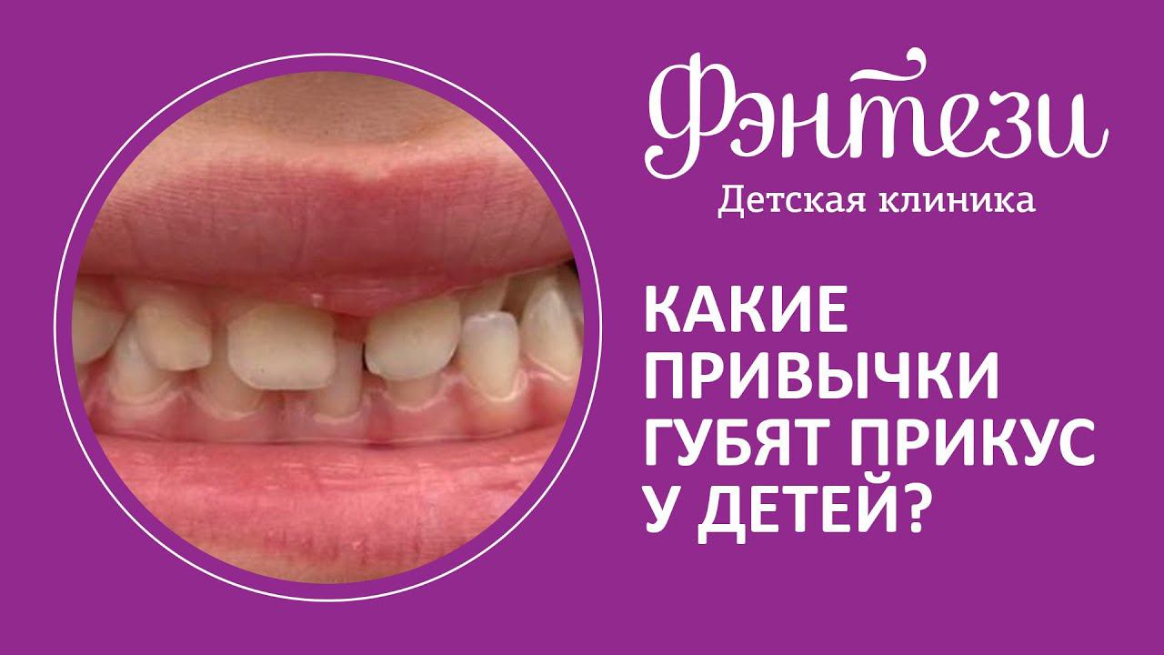 Какие привычки губят прикус у детей?