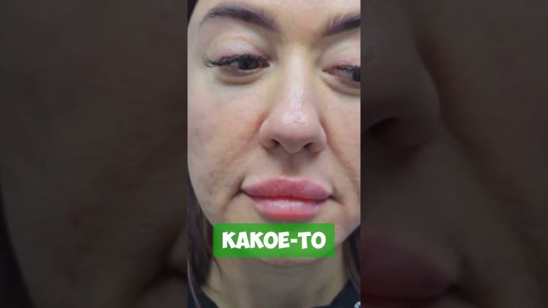 Что происходит с кожей после многих биоревитализаций
