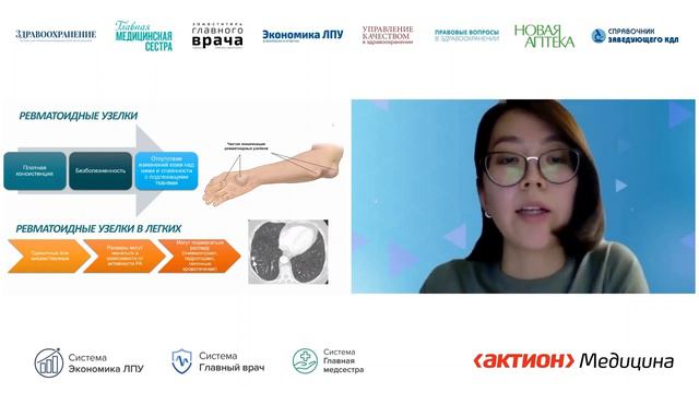 Клинические проявления ревматоидного артрита