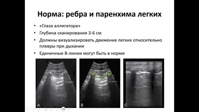 УЗИ грудной полости собак и кошек| Норма| Отрывок лекции