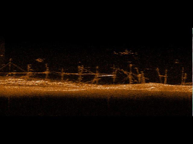 Garmin Echomap73SV & GT50  Down (depth 10m)