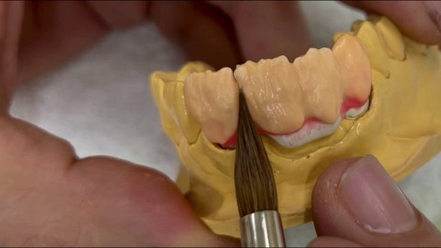 Нанесение керамики на протез с искусственной  десной -2