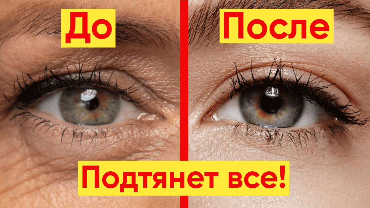 КАК ПОДТЯНУТЬ НАВИСШИЕ ВЕКИ – 3 ЭТАПА ПОДТЯГИВАЮЩЕГО ЛИФТИНГА!