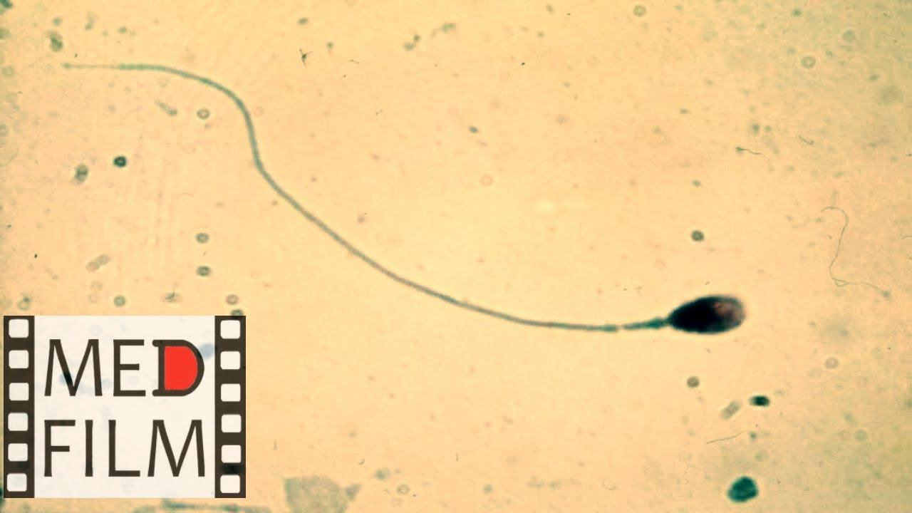 Сперматозоиды, эякулят, мужские половые клетки © Male sex cells, ejaculate, spermatozoa