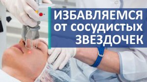 Удаление сосудов лазером. ? Как удалить сосуды с помощью лазера. Скандинавский центр здоровья.