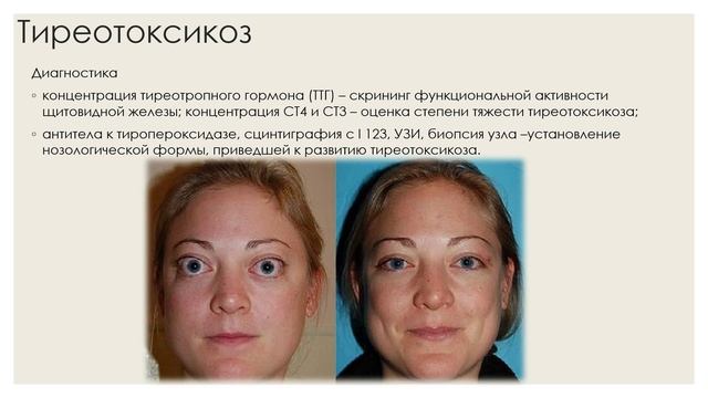 14. Прочие причины.mp4