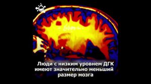 Влияние омега-3 на мозг
