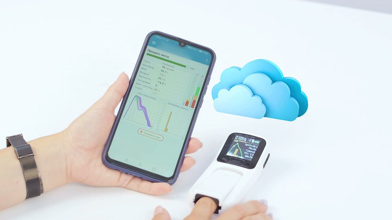 Трекер здоровья AngioCode -301