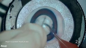 Prof. Vladimir Trubilin MD, Case 2