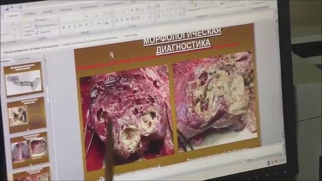 Дифференциально-диагностическое отделение РПТД 2016.mp4