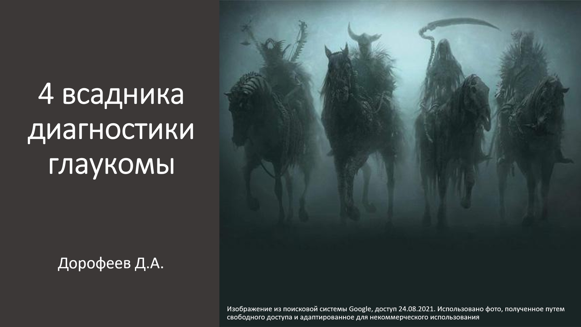 Школа глаукомы. 4 всадника диагностики глаукомы