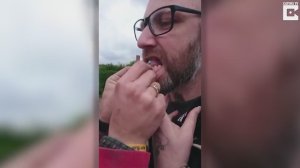 Парню пытаются вытащить зуб