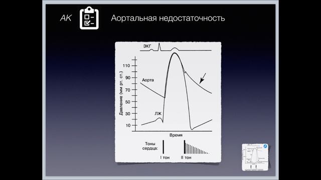 ППС-5-АН