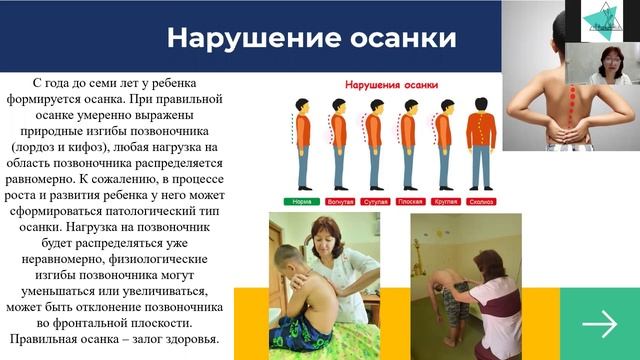 «Войта-терапия в реабилитации детей с особенностями развития и другие техники мануальной терапии»