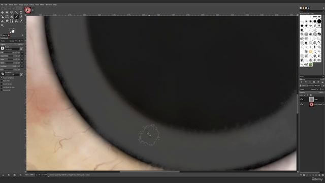4.10. Eyeball Rings