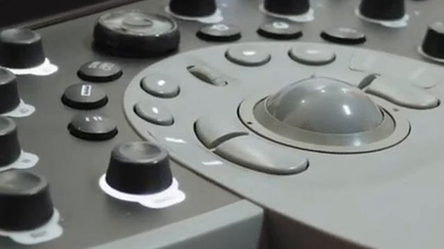 Siemens Acuson S2000