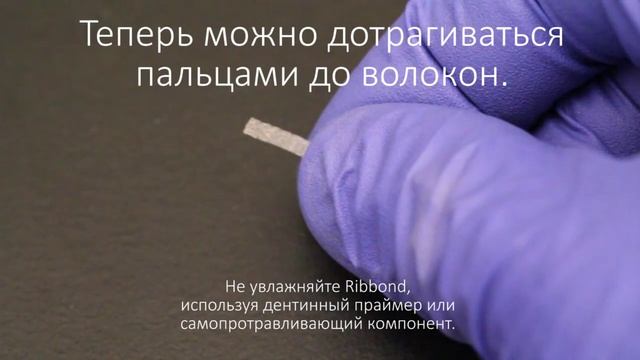 Мостовидные протезы  передних зубов при помощи Ribbond