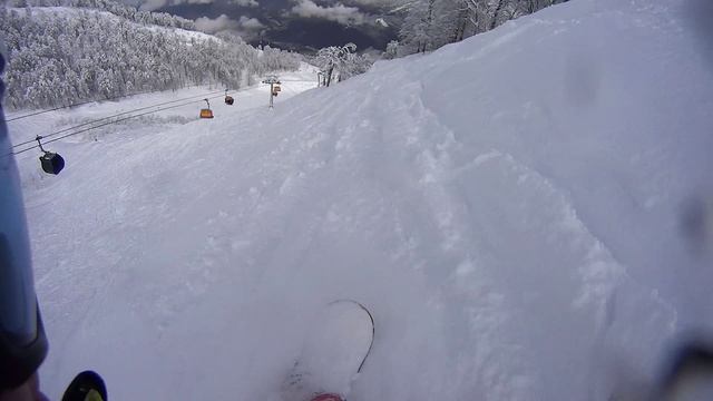 14_3 Забитые ноги сочи Альпика