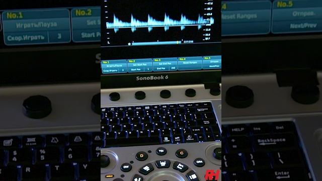 Chison Sonobook 6