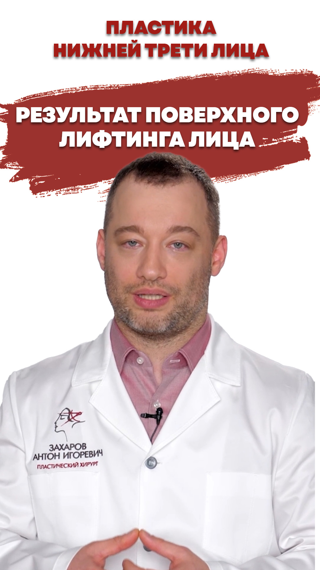 Результат поверхного лифтинга лица