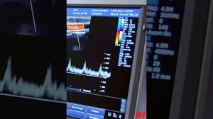 Chison Ebit 30