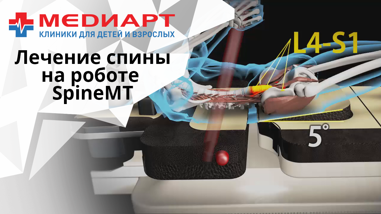Мобилизация и декомпрессия позвоночника на роботе SpineMT K-1 в клинике МедиАрт
