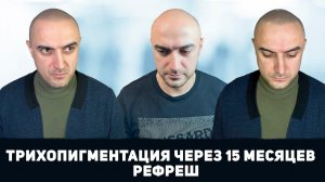 Трихопигментация  через 15 месяцев. Заживший результат перед рефрешем. Scalp Micropigmentation.