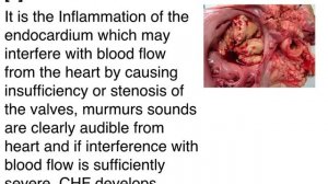 4 Hydropericardium