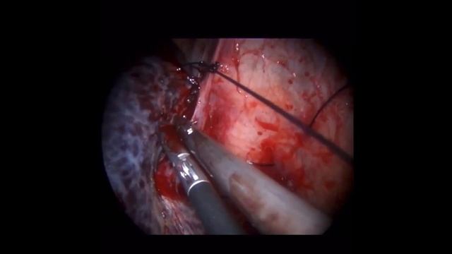 Из практики MAXIMA VET: Ушивание почечно-селезеночного пространства (ОПЫТ УНИКАЛЬНОЙ ОПЕРАЦИИ)